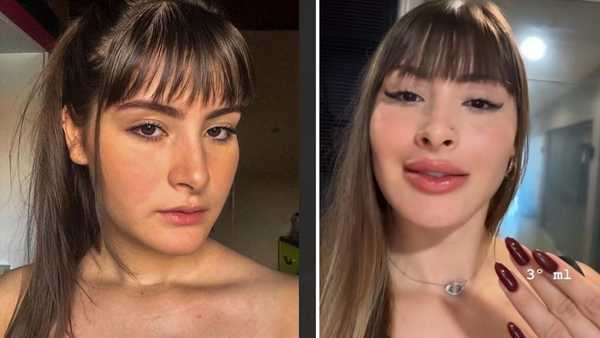 Agatha Sá, namorada de Filipe Ret, mostra antes e depois de ...