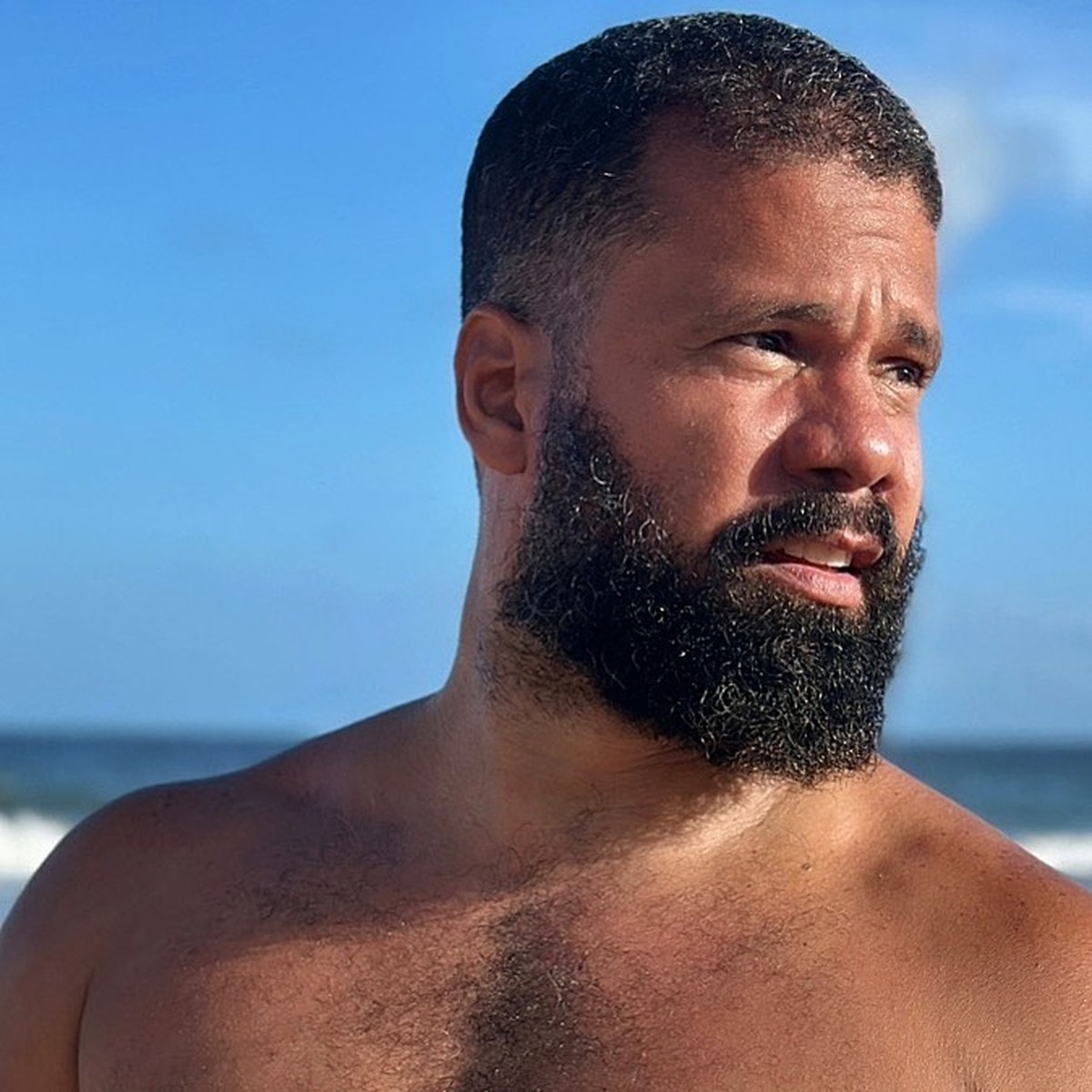 Júnior Chicó relembra mordida de cachorro que levou em date conturbado ...