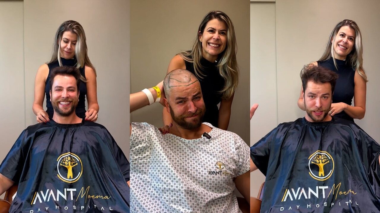 Ex-BBB Gustavo Marsengo fica careca para realizar cirurgia de ...