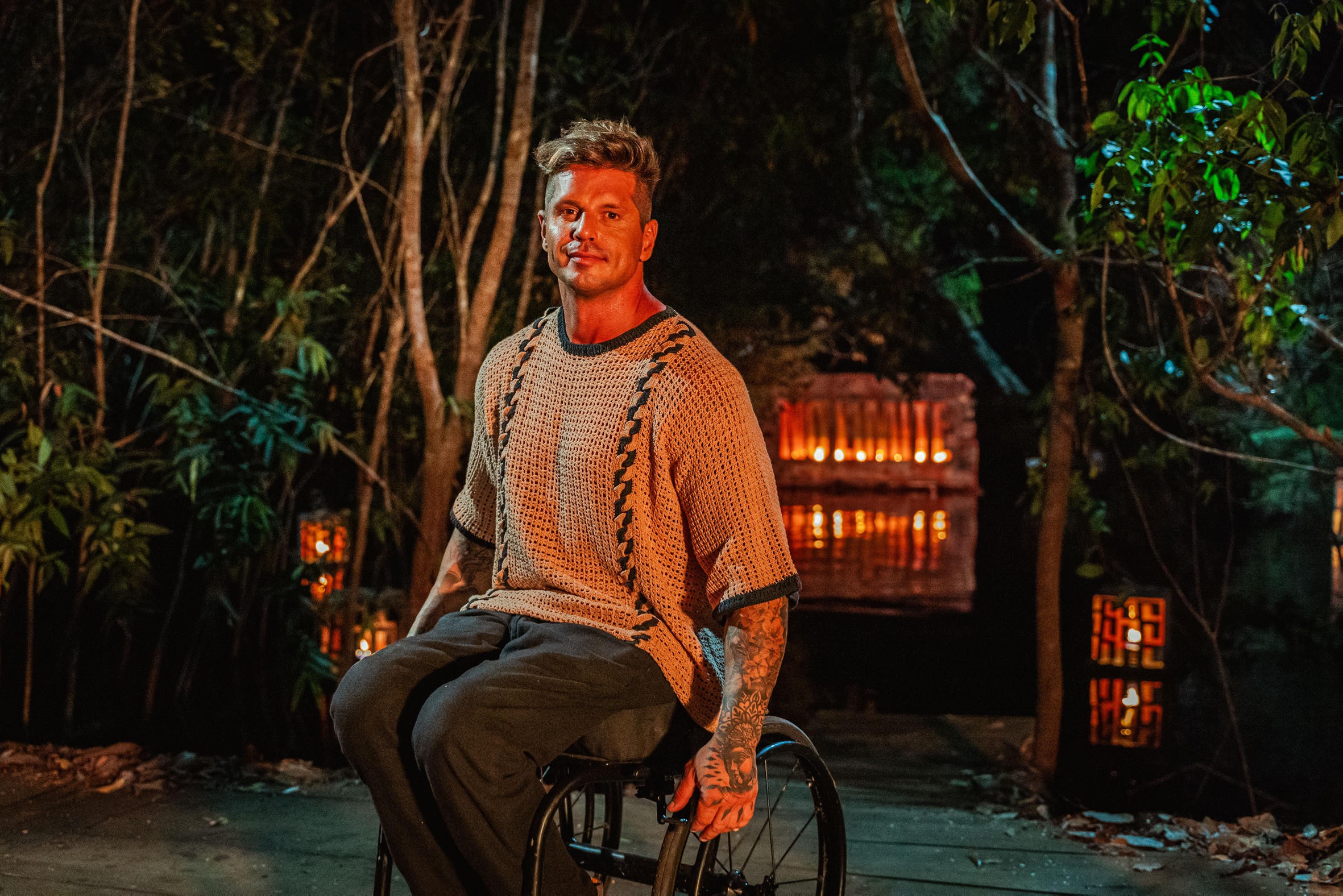 Fernando Fernandes sofre lesão e vai passar por cirurgia no braço ...