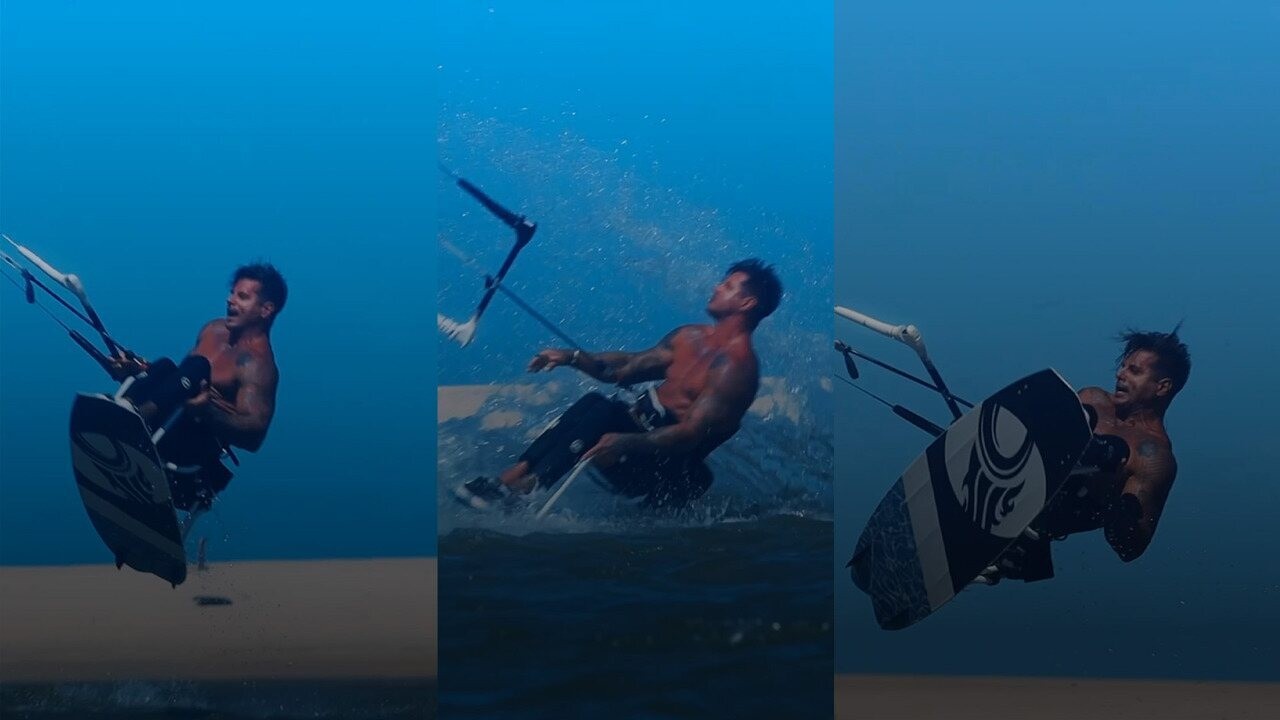 Fernando Fernandes se recupera bem de cirurgia; veja momento do ...