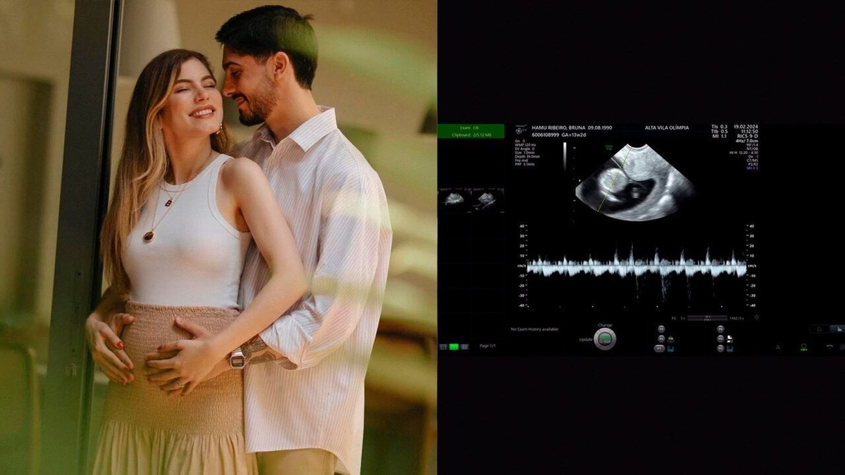 Bruna Hamú anuncia que está grávida: 'Agora somos quatro' | Famosos | gshow