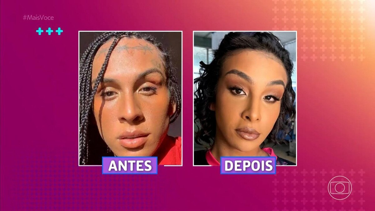 Linn da Quebrada brinca sobre aparência após cirurgia de 'feminização ...