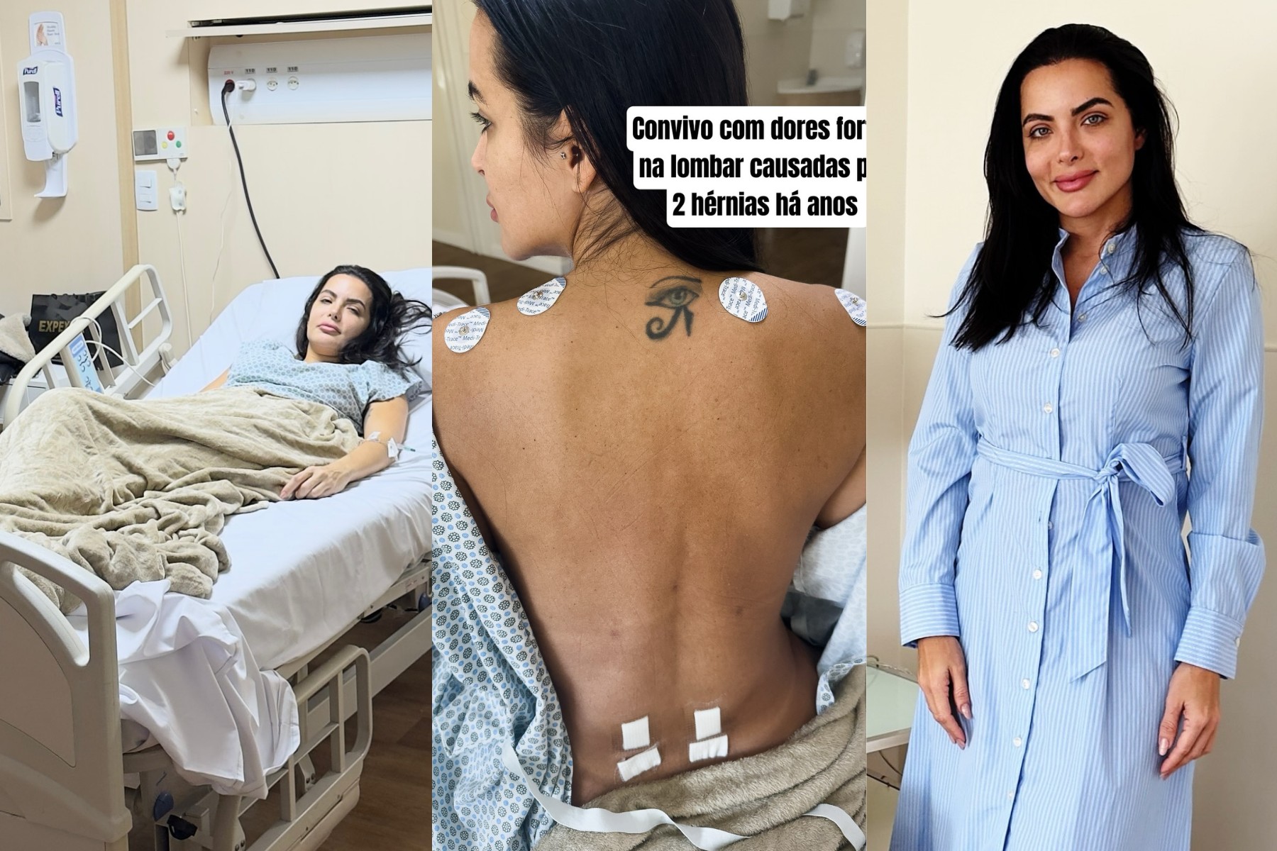 Carla Prata conta detalhes de cirurgia na coluna: 'Enfrentei mais uma batalha' | Gshow