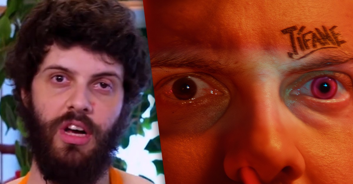 Diogo Defante mostra resultado de correção de pálpebra e brinca: 'Mais ...