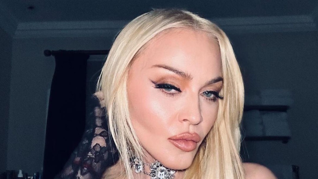 Madonna | Artistas | GSHOW