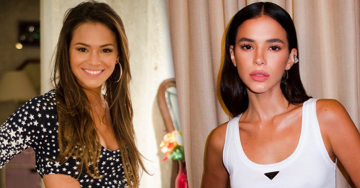 Veja antes e depois de famosos que já fizeram rinoplastia | Gshow