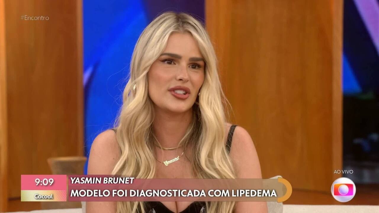 Assim como Yasmin Brunet, veja outras famosas que convivem com o ...