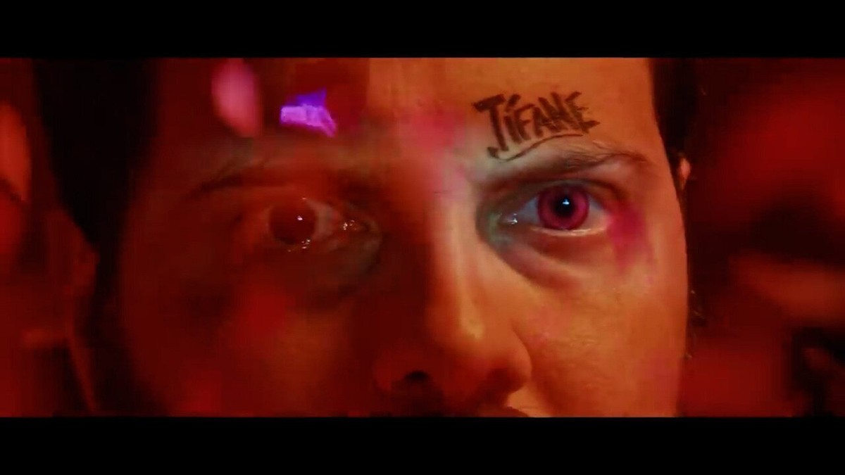 Diogo Defante mostra resultado de correção de pálpebra e brinca: 'Mais ...