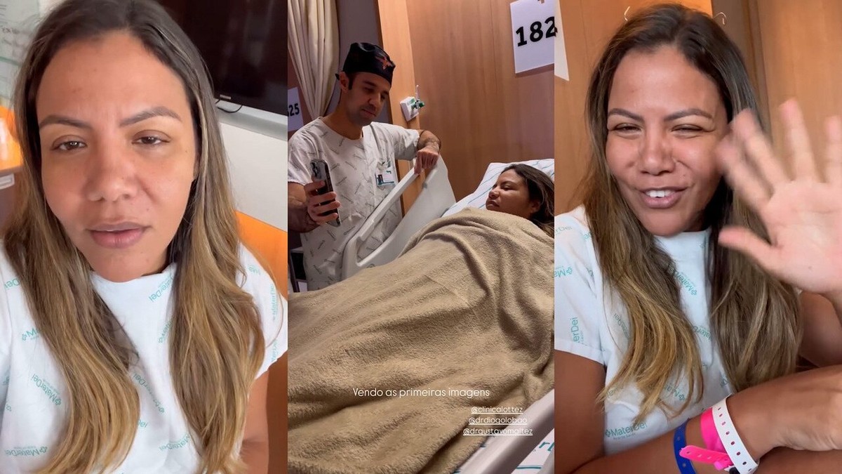 Mani Reggo, ex de Davi Brito, fala sobre cirurgia plástica: 'Vou ficar ...